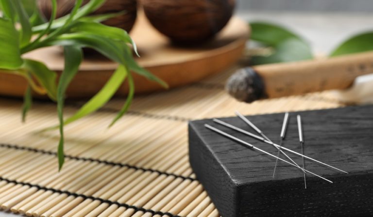 5 Surprising Things New Research is Revealing About Acupuncture ...